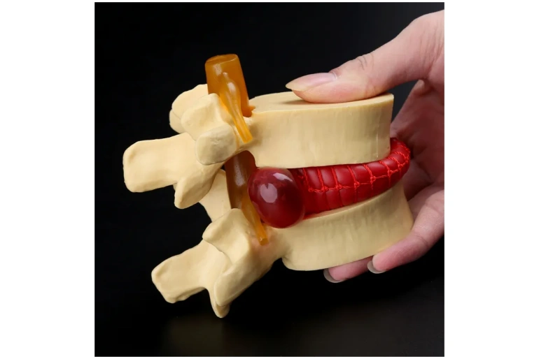 Medical props model Anatomical Spine Lumbar Disc